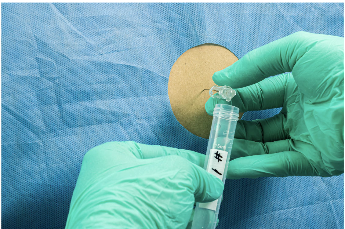 Punção (PAAF) - UltraCare