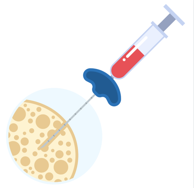 Punção (PAAF) - UltraCare